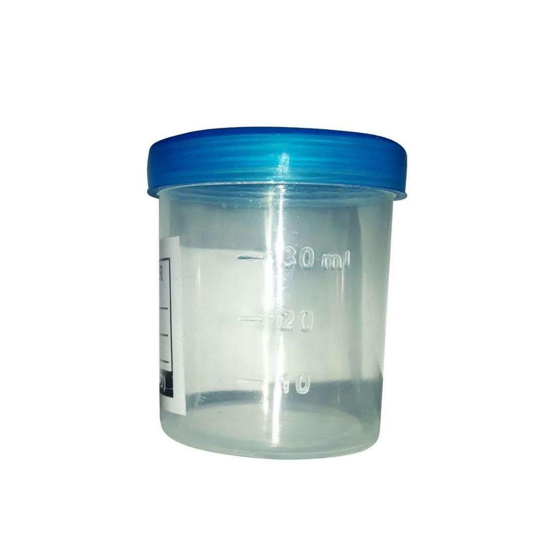 Urine Container (30ml) - Lab Wale