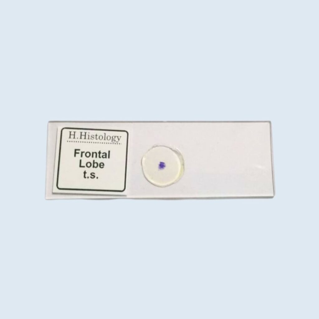 Histology- Hyalin Cartilage - Transverse Section - Permanent Slide