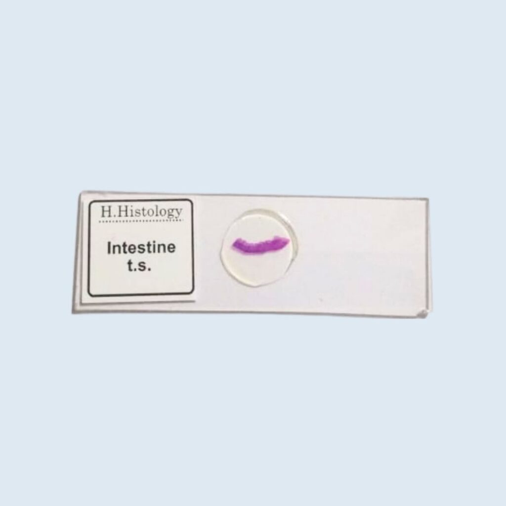Histology- Hyalin Cartilage - Transverse Section - Permanent Slide