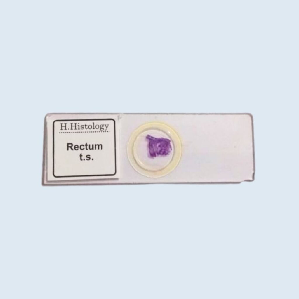 Histology - Prostate Gland - Transverse Section - Permanent Slide