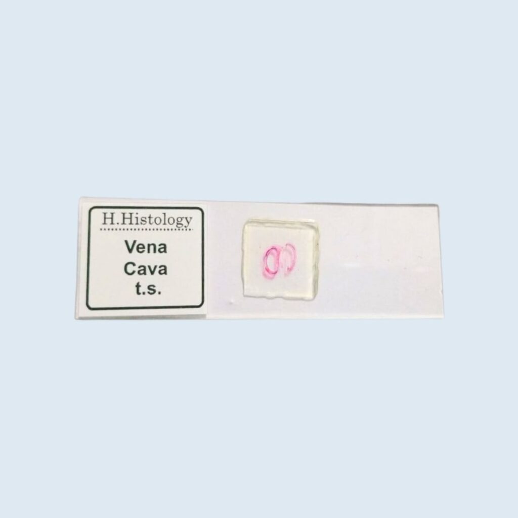 Histology - Vein - Transverse Section - Permanent Slide
